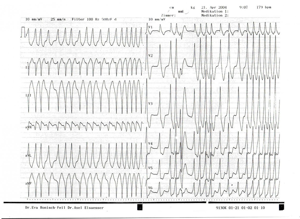 Electrical cardioversion – Kardiologische Praxis Burgstraße